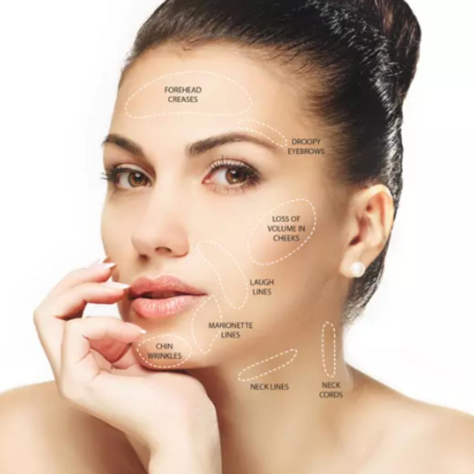 What is Facial cupping? Everything you need to know