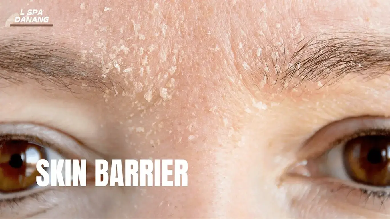 What Is The Skin Barrier? Everything You Should Know - L Spa Da Nang
